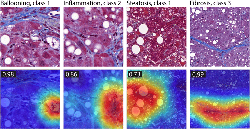 Overfitting in Machine Learning